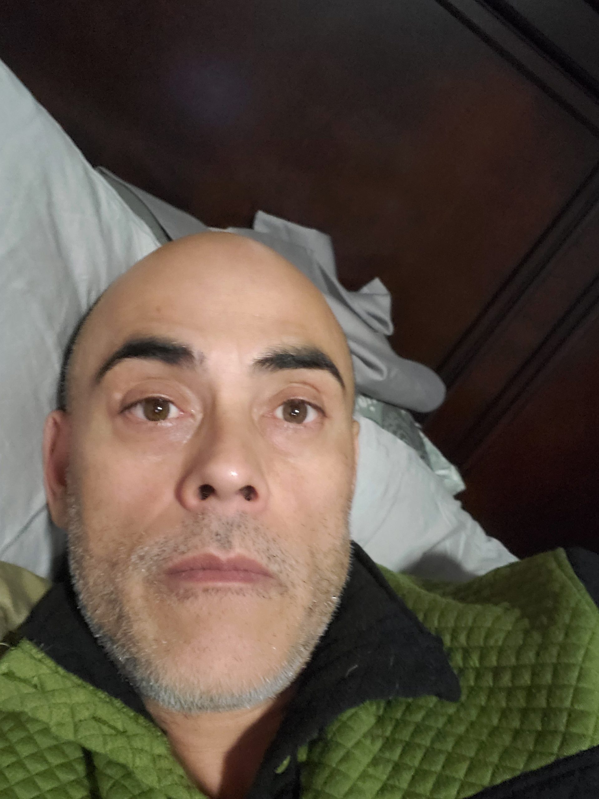 Shoulder damage | Precision Touch Therapy